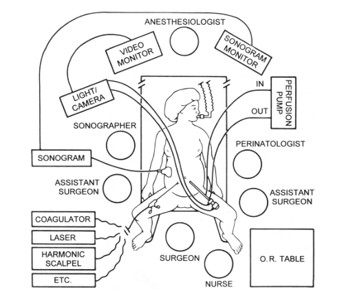 CAN THIỆP BÀO THAI (FETAL INTERVENTION) - CÔNG TY TNHH MTV TƯ VẤN SỨC ...